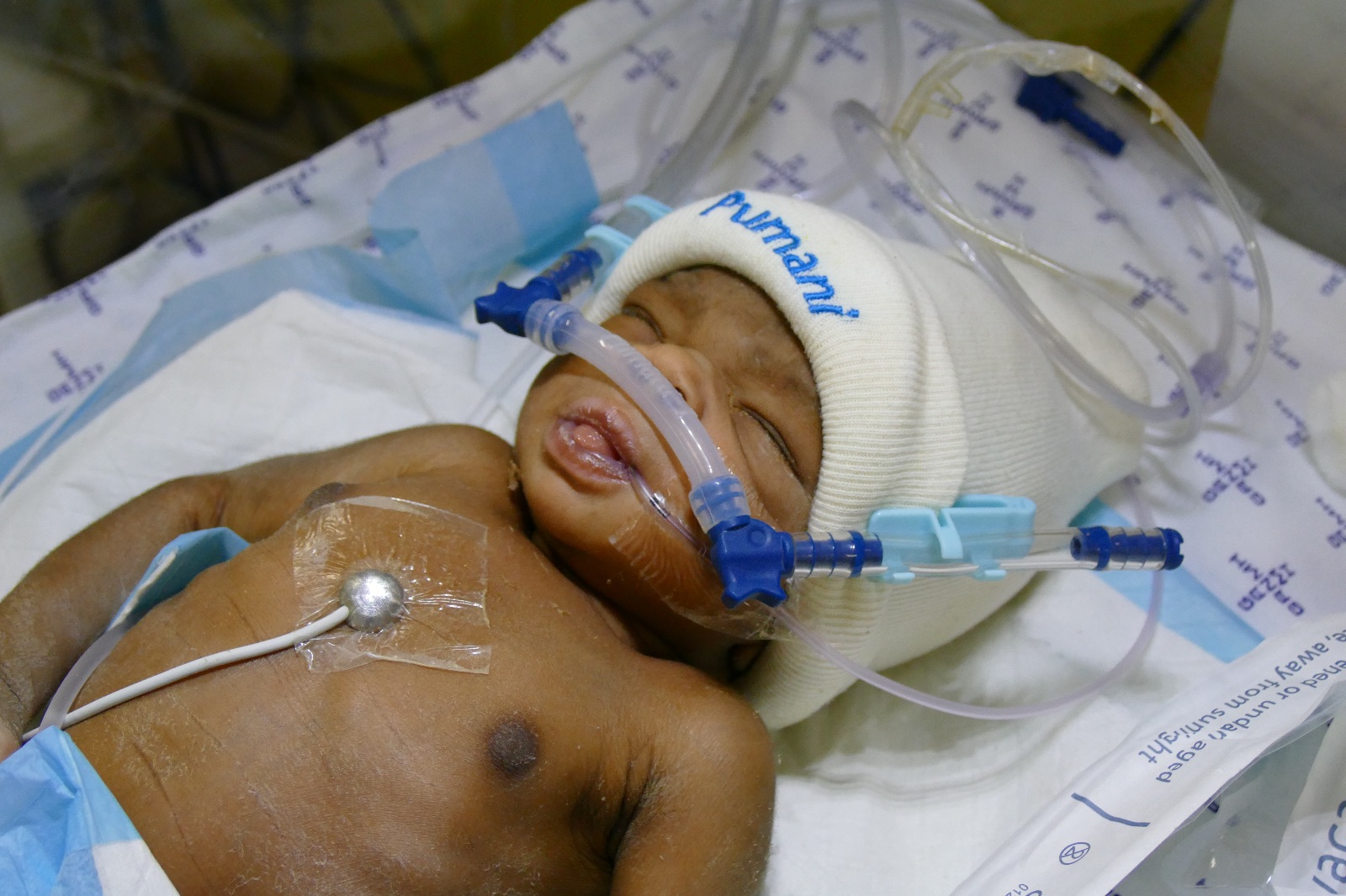 Neo For Namibia – Helping Babies Survive